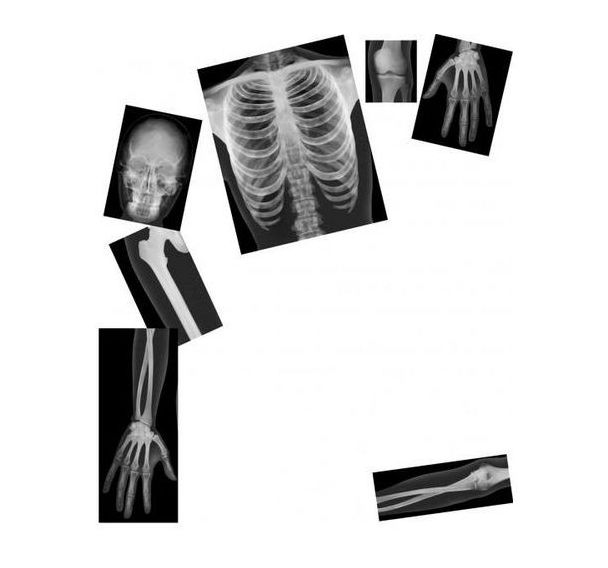 Le corps humain aux rayons X | Manutan Collectivités